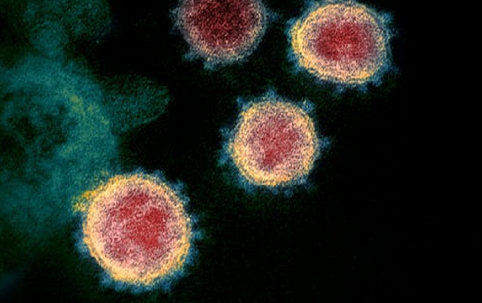 Sandra Goñi "La mayoría de las nuevas virosis se vinculan con cambios ...